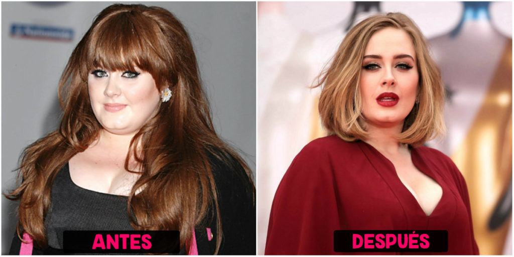 Cirugías de Adele (+Antes y después) - Cirugias.de
